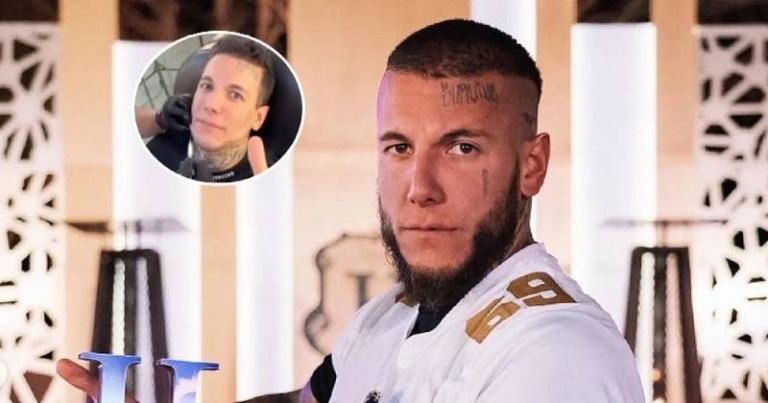 Alex Caniggia contó qué sienten las mujeres al ver su nueva mandíbula ...